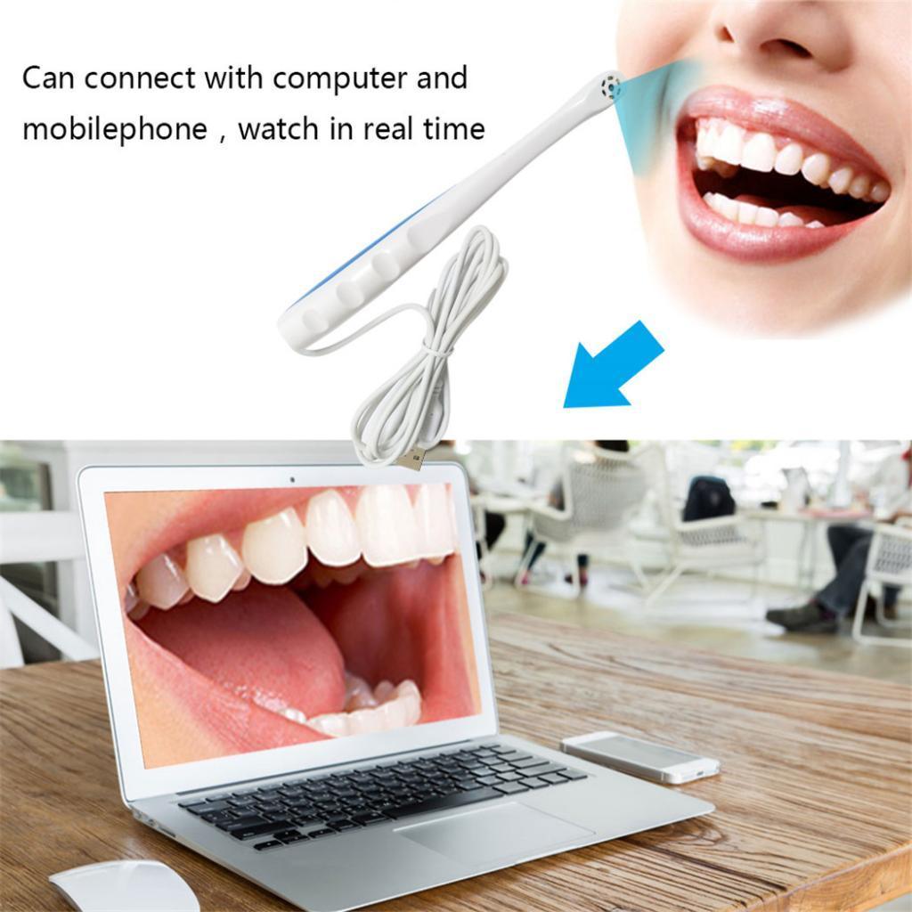 ⚡️Buy Maxbell USB 2.0 8MP 6-LED Dental Intraoral Endoscope Oral Digital ...